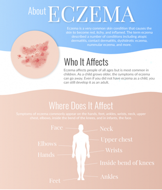 Paediatric eczema - GS SCORE