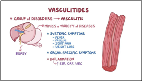 The Auto-Immune Inflammation of Blood Vessels: Vasculitis Explained ...