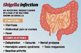 Shigella infection in Kerala - GS SCORE
